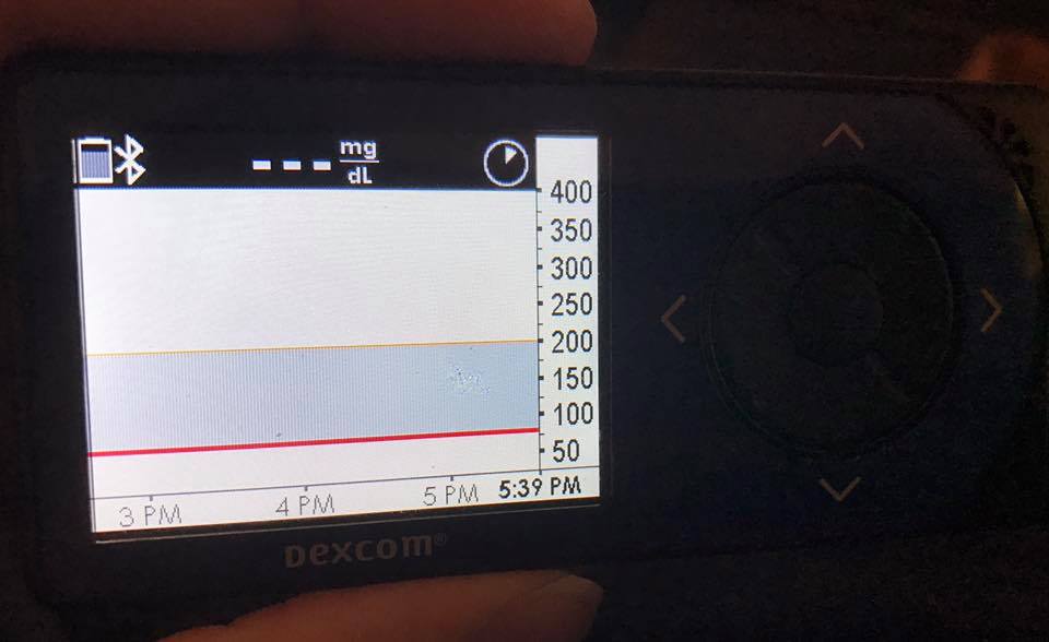 Adding a Dexcom to my Diabetes Toolbox | My Diabetic Heart